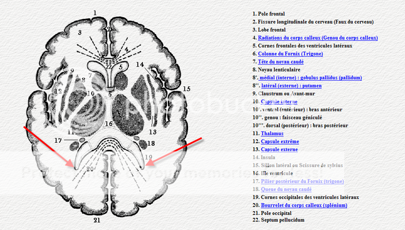 Ventricules Latéraux; Ventricule latéral