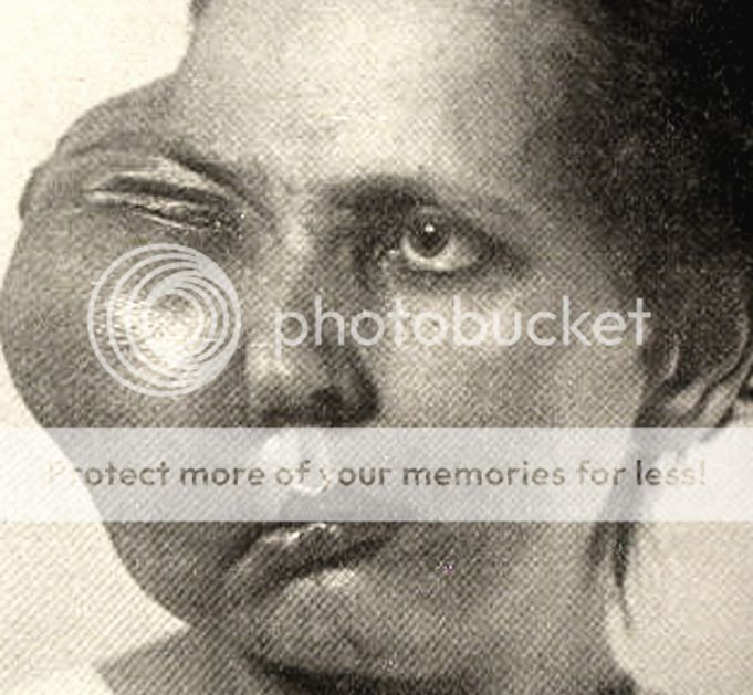 MASSIVE FREAKS PHOTOS Old GRAPHIC HORRIFIC Medical Book 1928 UNCENSORED ...