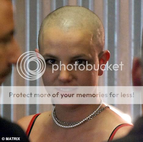 Do you think that losing your hair and being bald changes the way ...