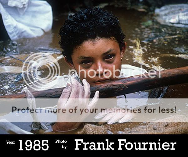 Gangrena Di Fournier