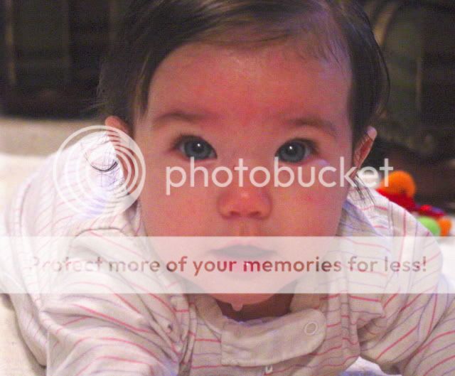 Cross-eyed babies | Mothering Forum