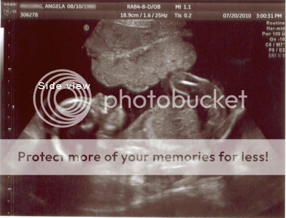 Here I Am, Now What?