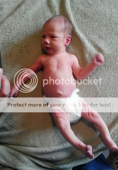 Skinny babies and inflated birth weight (PIC) | BabyCenter