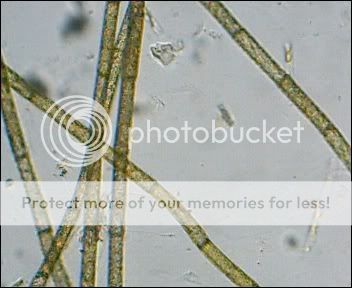 Trotz Regenwasser, CO2-Düngung und vielen Pflanzen Algenplage | Seite 2