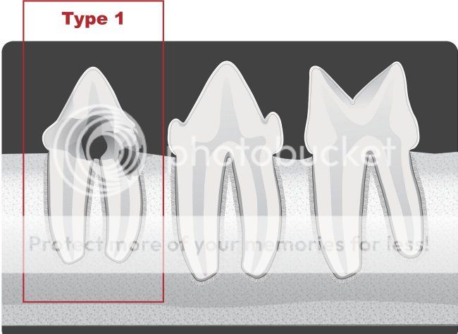 Feline dentistry - let's talk about FORLs! | UK Pet Forums Forum