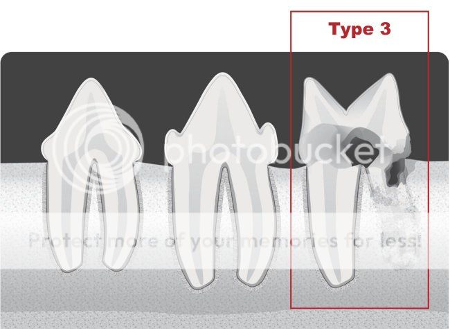 Feline dentistry - let's talk about FORLs! | UK Pet Forums Forum