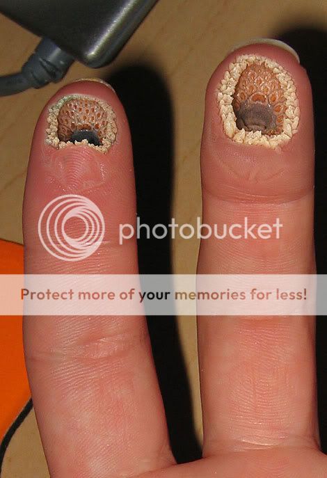 trypophobia: Fear of holes - Ultimate Guitar