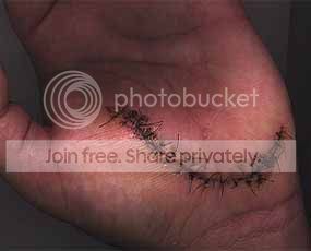 WTF Messed up fingers pic. Graphic > General Discussion > AR15.COM